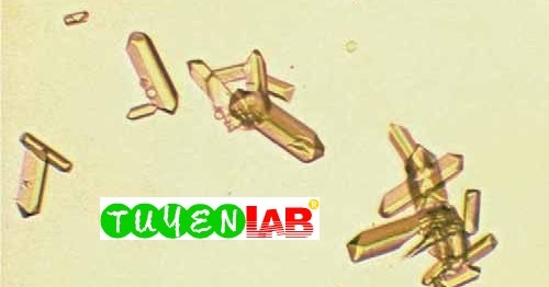 Atlas of Crystals found in alkaline urine | Free Medical Atlas