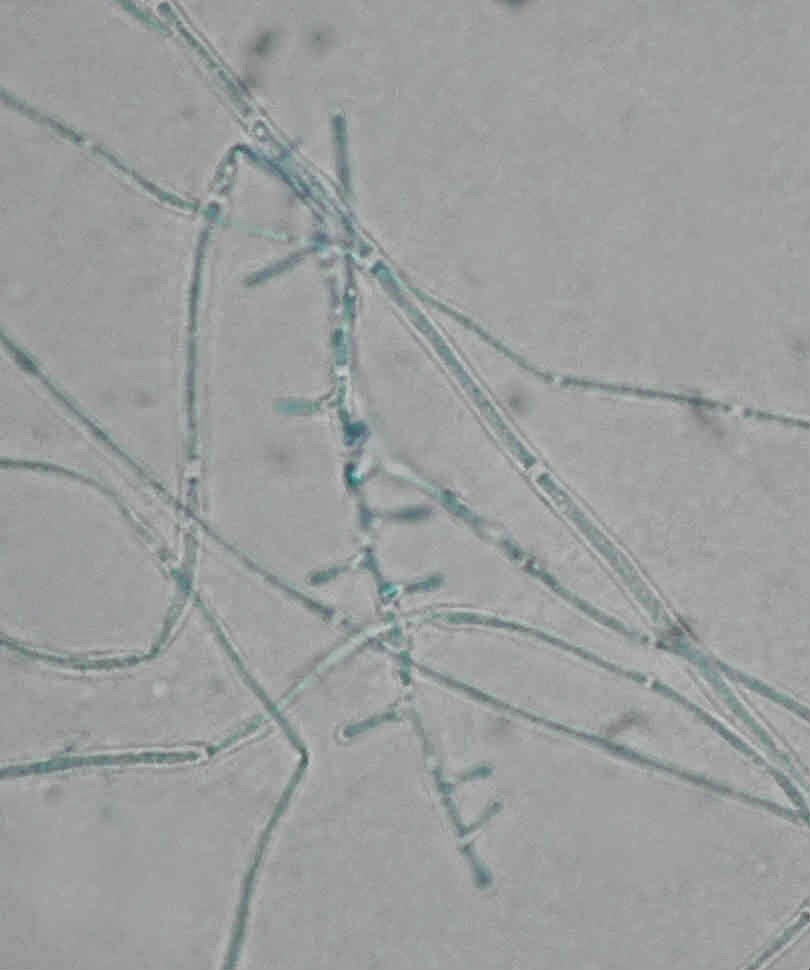ATLAS MICOLOGIA: TRICHOPHYTON TONSURANS (2)