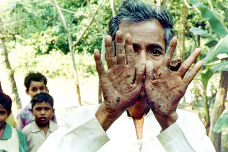 Arsenic | Sri Lanka Guardian