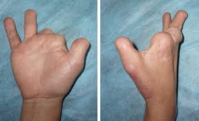 Soy Criminalista : DACTILOSCOPIA