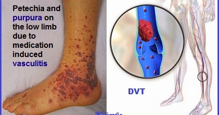 Nutrition & Natural Medicine News: Traditional Chinese medicine formula ...