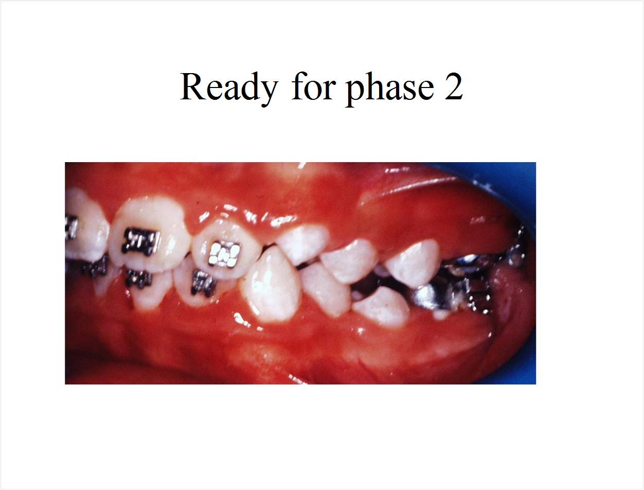 practical orthodontics: Diagnosis and treatment of mesially rotated ...