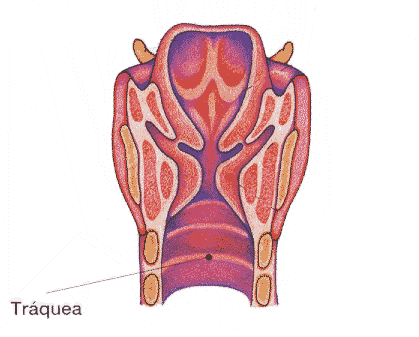 Se busca una traquea extraviada