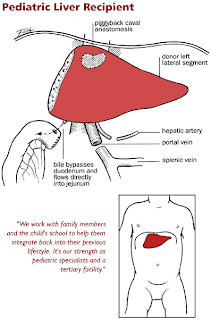 The Links: Some Details About the Surgery