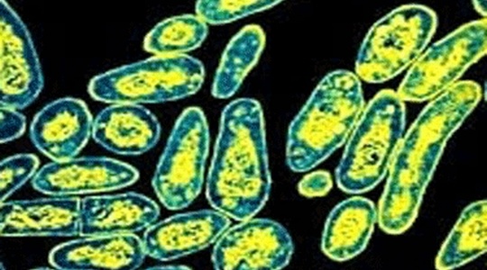 Ucimo biologiju preko Racunara: Bakterije