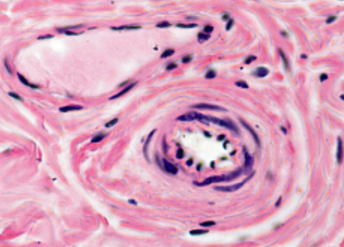 Histología Básica y Sistémica: Sistema Cardiovascular I