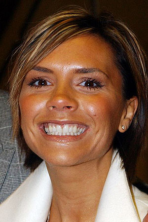 Victoria Beckham Teeth