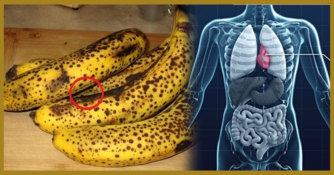 10 Proven Health Benefits Of Eating Black-Spotted Bananas