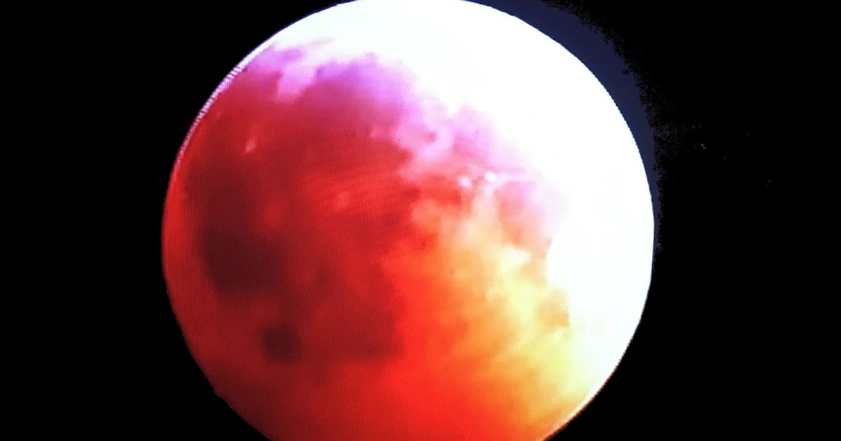 Israel Vision TV: Super Moon~Blue Moon~Blood Moon Over Israel!