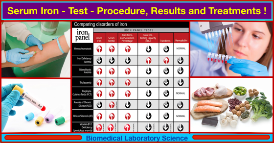 In this article, learn more about the uses of a serum iron test. We ...
