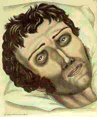 Infection Landscapes: Cholera