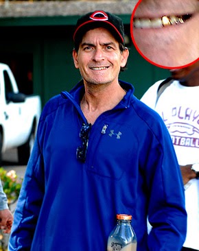 Celebrity Gossip and Entertainment News: Charlie Sheen's Gold Grill