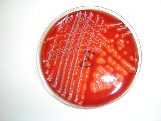 KLIMAKS: BAKTERIOLOGI