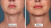 5 Simple Ways To Tighten Your Neck Skin