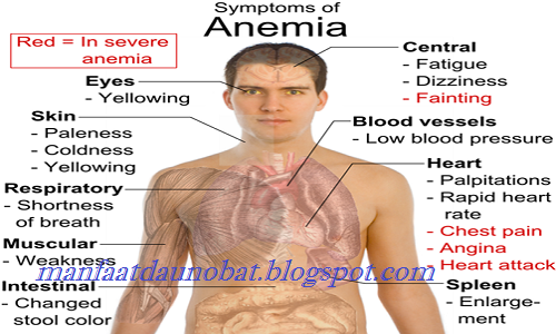 Cara Mengatasi Anemia Dengan Cara Alami - Jantung Sehat