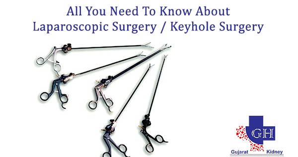 All You Need To Know About Laparoscopic Surgery / Keyhole Surgery
