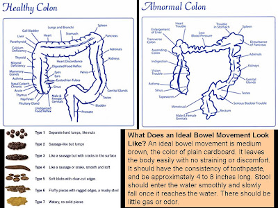 Dr Mat: Stool - Healthy and Unhealthy Stool. What does your stool say ...
