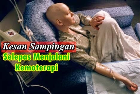 Mengenai Kanser dan Supplement Anti Kanser: Rawatan Kemoterapi