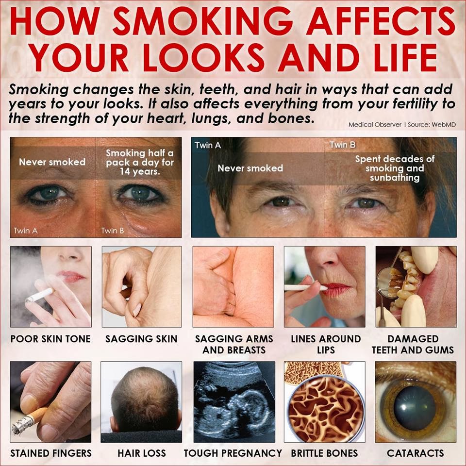 Free Health Tips | Good Nutrition | Healthy Diet Child: How Smoking ...