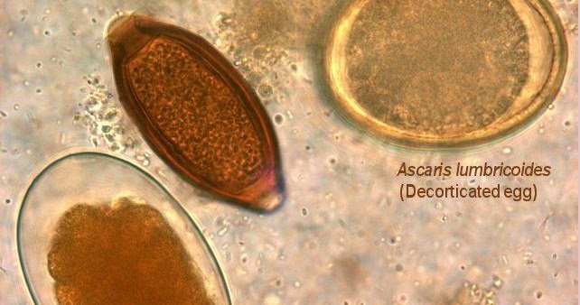 Parasitologia Tercer Semestre: Diagnostico diferencial de uncinariasis