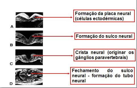 Crista neural