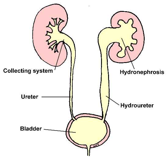 Kenali Infeksi Saluran Kencing - Obat Sakit 2011
