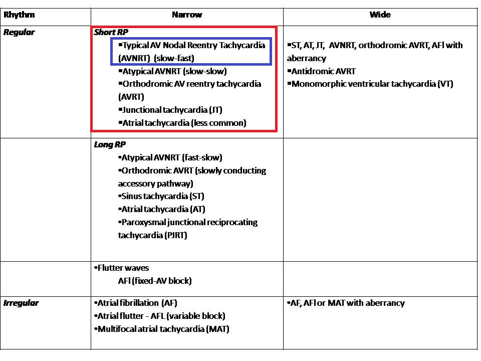ECG Rhythms: A Narrow Complex Tachycardia