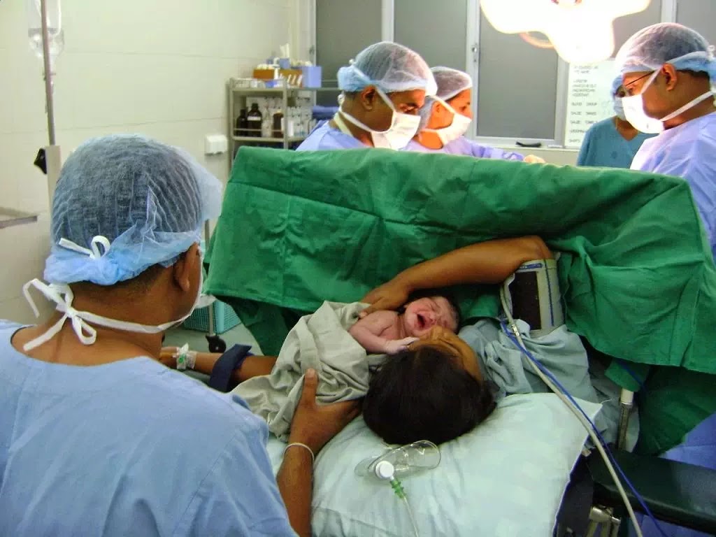 The caesarean surgery has negative effects for the woman`s health