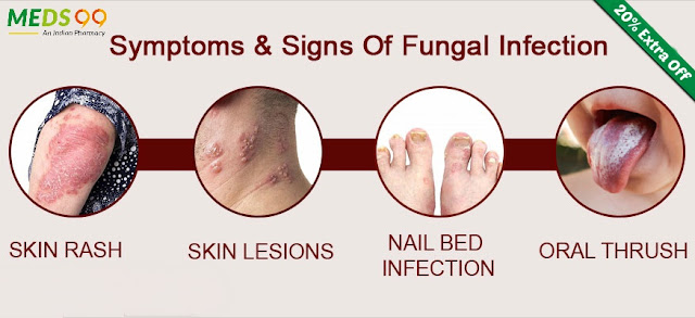 Itraconazole: Best solution for fungal infections ~ Women's Care Group