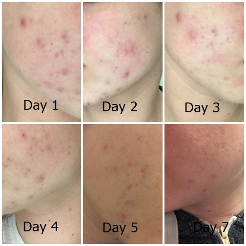 BAKING POWDER - NOT JUST FOR BAKING - Pam's Beauty Blog