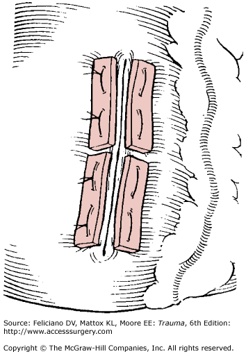 Stories from the trauma bay: February 2016