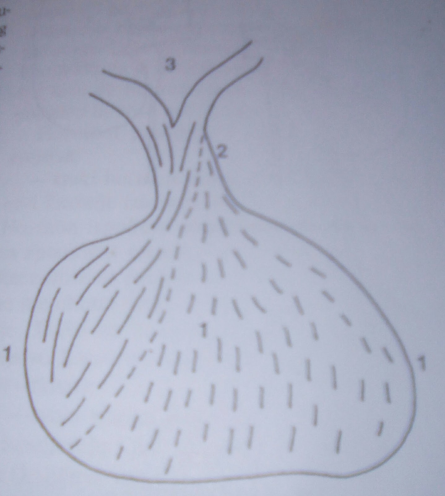 Latinski jezik za medicinske škole: Hipofiza(glandula pituitaria)