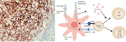 Pathology Cases: LN review