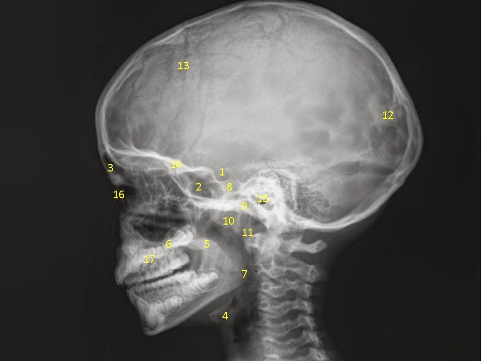 E-Anatomía Odontológica: noviembre 2014