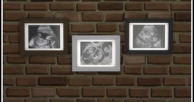 LittleMsSam's Ultrasound Scan Mod