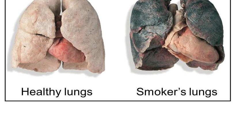 Search for Personal Health: Dating naninigarilyo o nais huminto