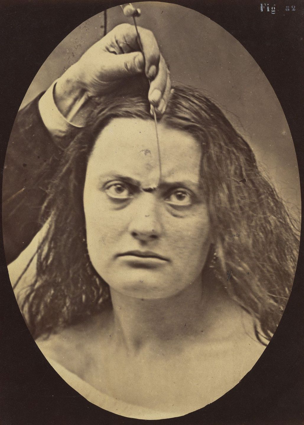 Neuroscience Experiments From the 19th Century: Bizarre and Creepy ...