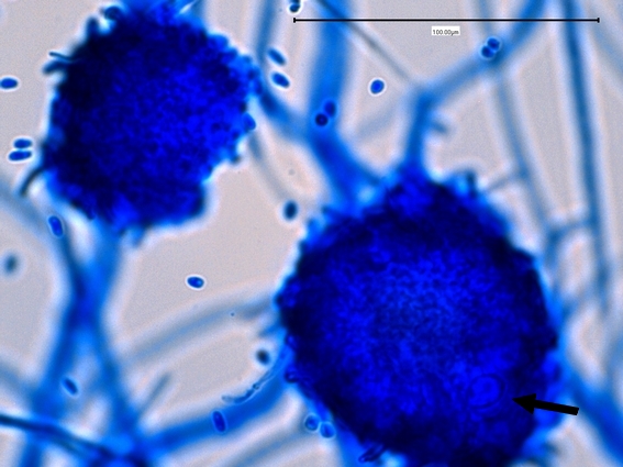 Fun With Microbiology (What's Buggin' You?): Phoma glomerata