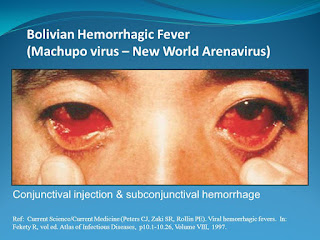 Vírus Machupo - FHB : História,Epidemiologia,Patogenicidade,Transmissão ...