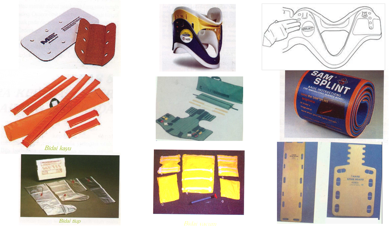 Materi PP: Pembidaian | PMR MTS ALKAUTSAR