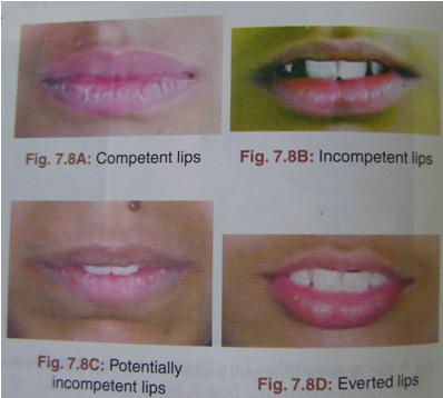 Dentistry lectures for MFDS/MJDF/NBDE/ORE: History taking and ...