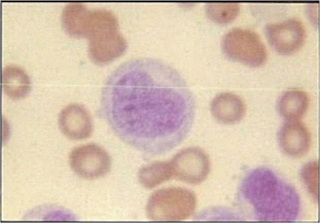 Celulas Sanguineas: Atlas de hematología: Monopoyesis y Linfopoyesis