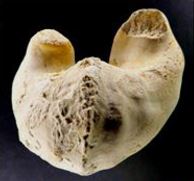 FOSSILES DE CHARENTE-MARITIME ET AUTRES ORIGINES: BIVALVES : rudistes