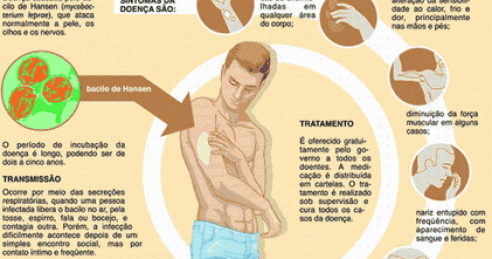 Missão Saúde: Hanseníase