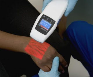 medical: How to find a difficult vein for Venipuncture