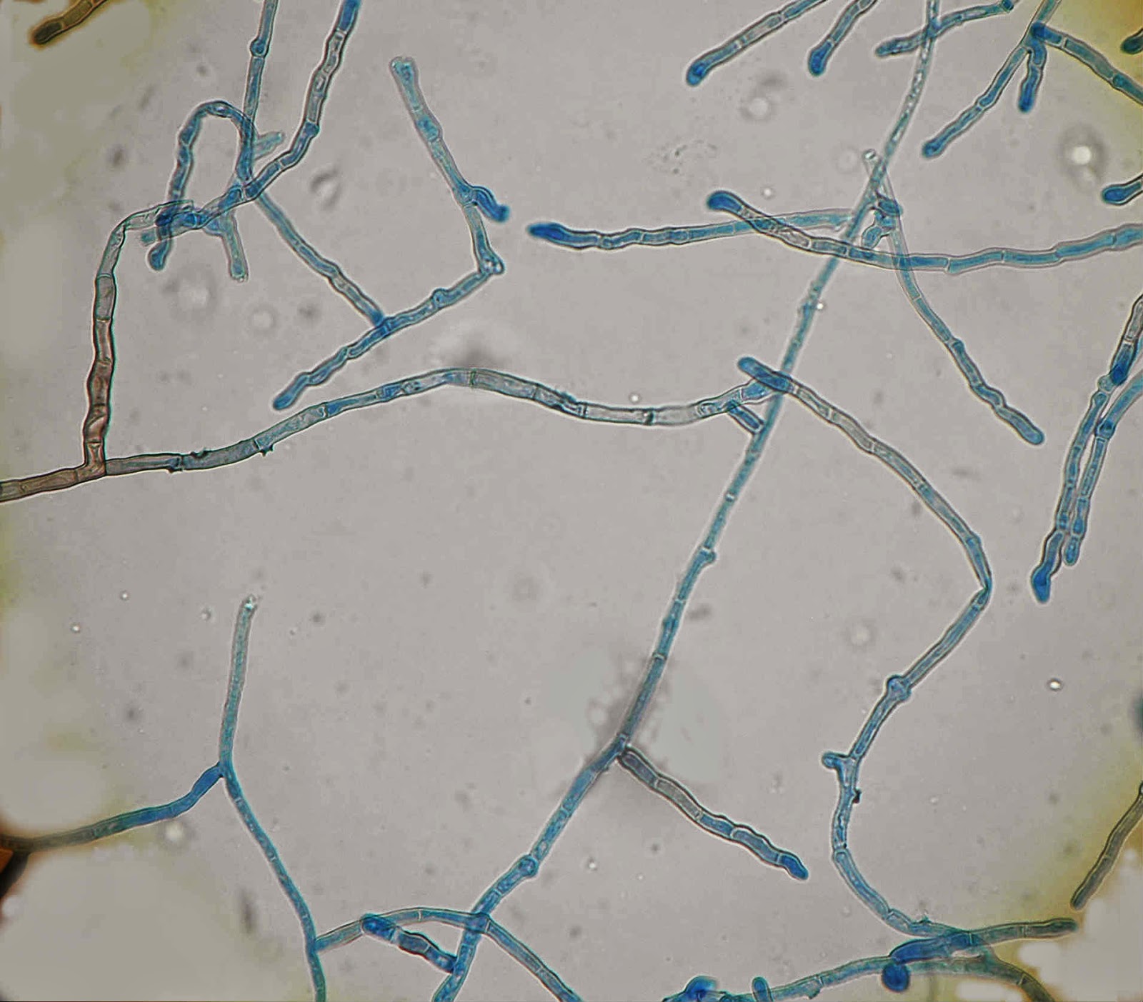 ATLAS MICOLOGIA: EXSEROHILUM ROSTRATUM
