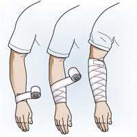 PRIMEROS AUXILIOS : VENDAJES