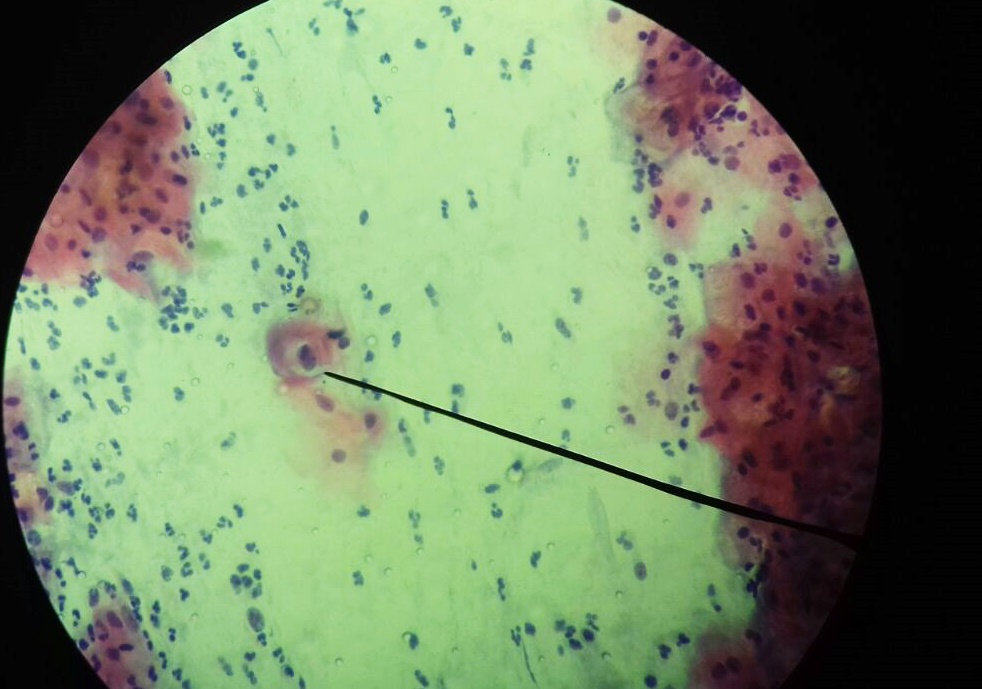Citopatologia Oncótica: 2017