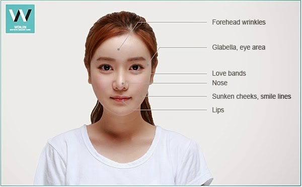 Perawatan Filler Untuk Efek Awet Muda