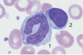 [Haematology] Normal Cells of the Blood and Hematopoietic Organs | Free ...